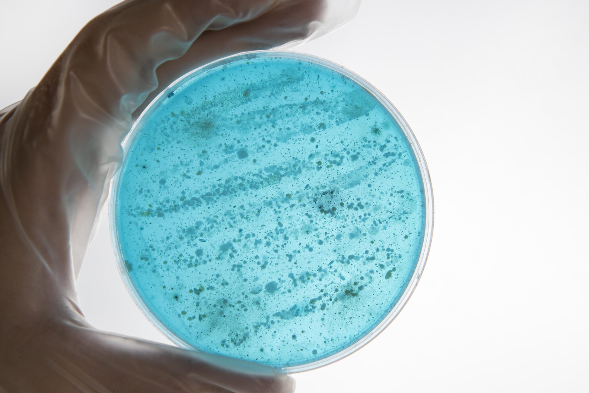 Microbiome Tests - Neurodigigen